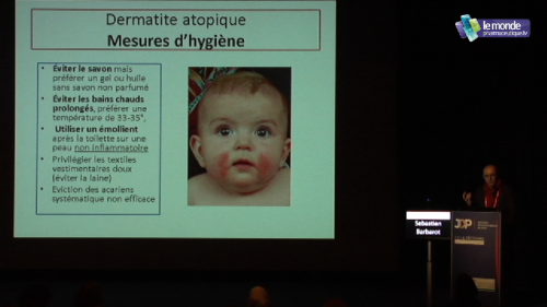 Dermatite-atopique-hygiene